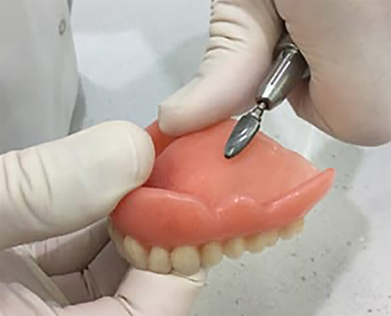 Reline – Smile Zone Denture